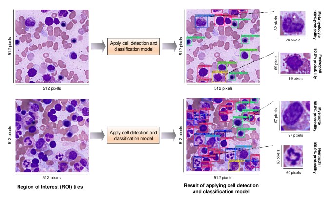 Histogram of Cell Types: Deep Learning for Automated Bone Marrow Cytology | DeepAI