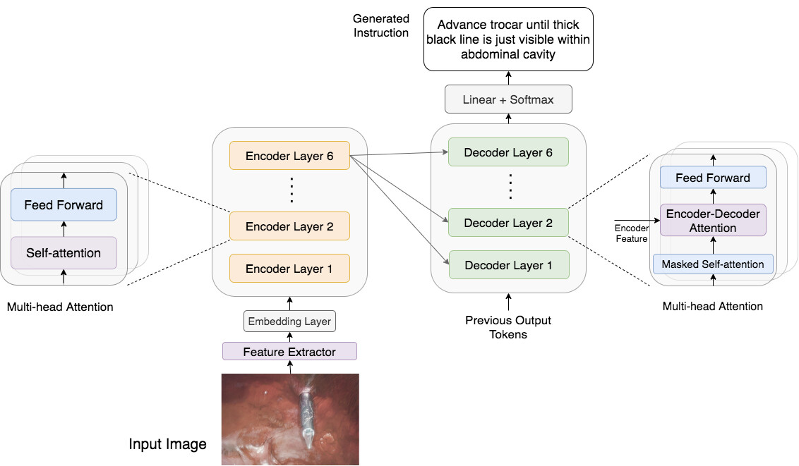 Surgical Instruction Generation with Transformers | DeepAI