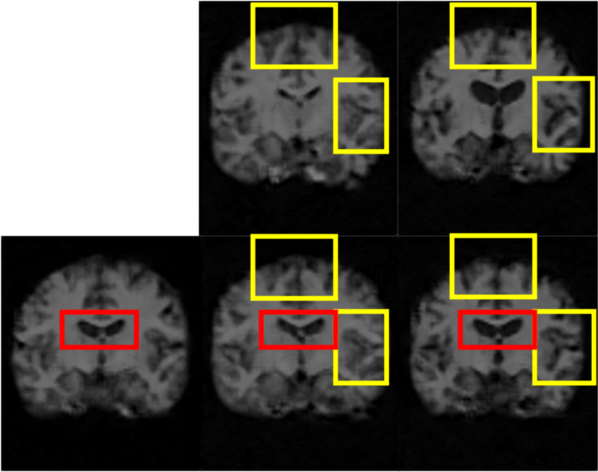 3d Stylegan A Style Based Generative Adversarial Network For Generative Modeling Of Three