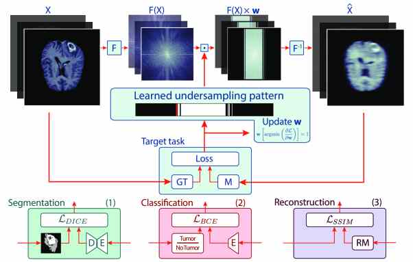 Optimal MRI Undersampling Patterns for Ultimate Benefit of Medical ...