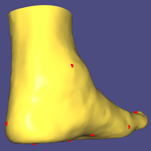 Anatomical Landmarks Localization for 3D Foot Point Clouds | DeepAI