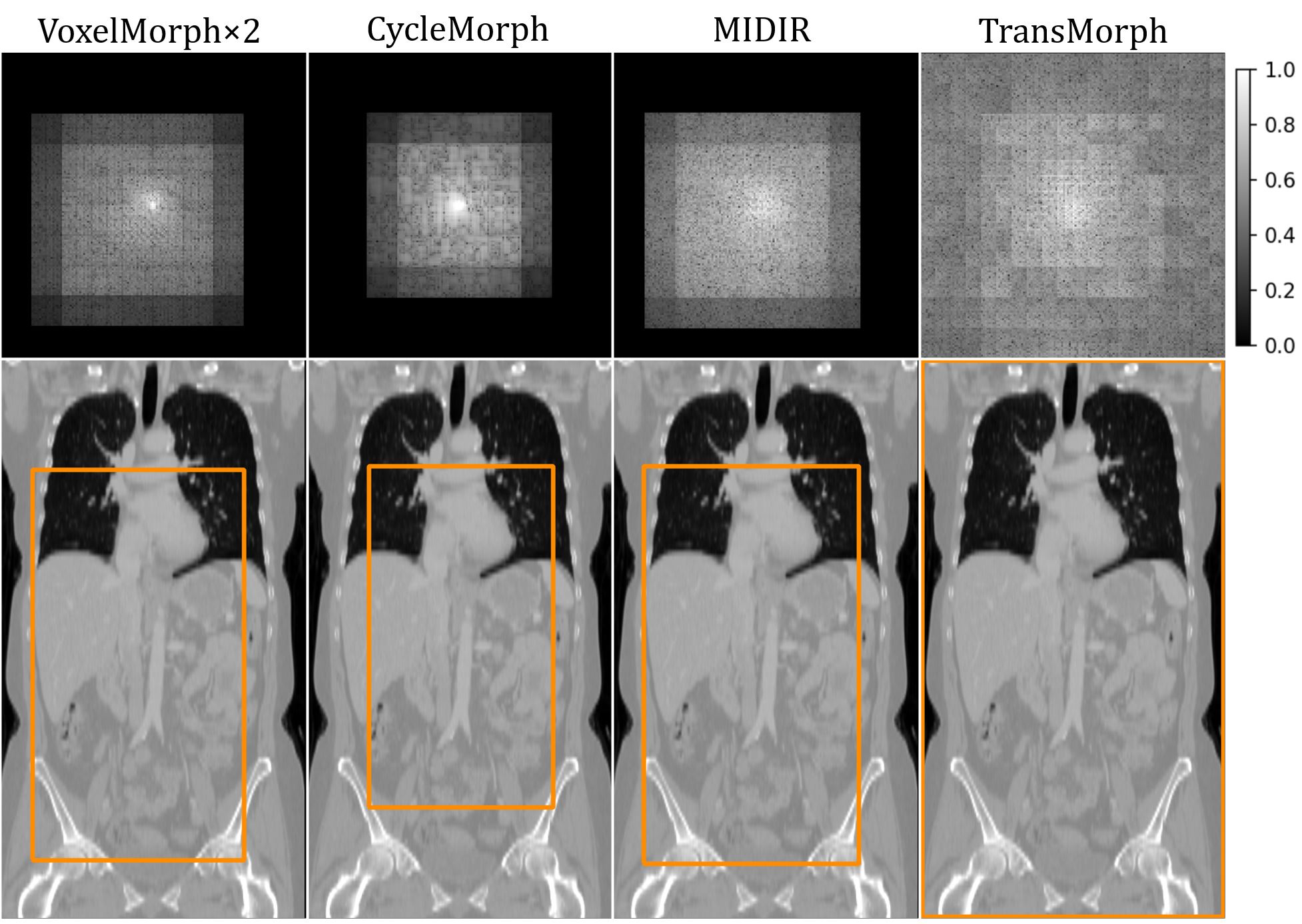 TransMorph: Transformer for unsupervised medical image registration | DeepAI