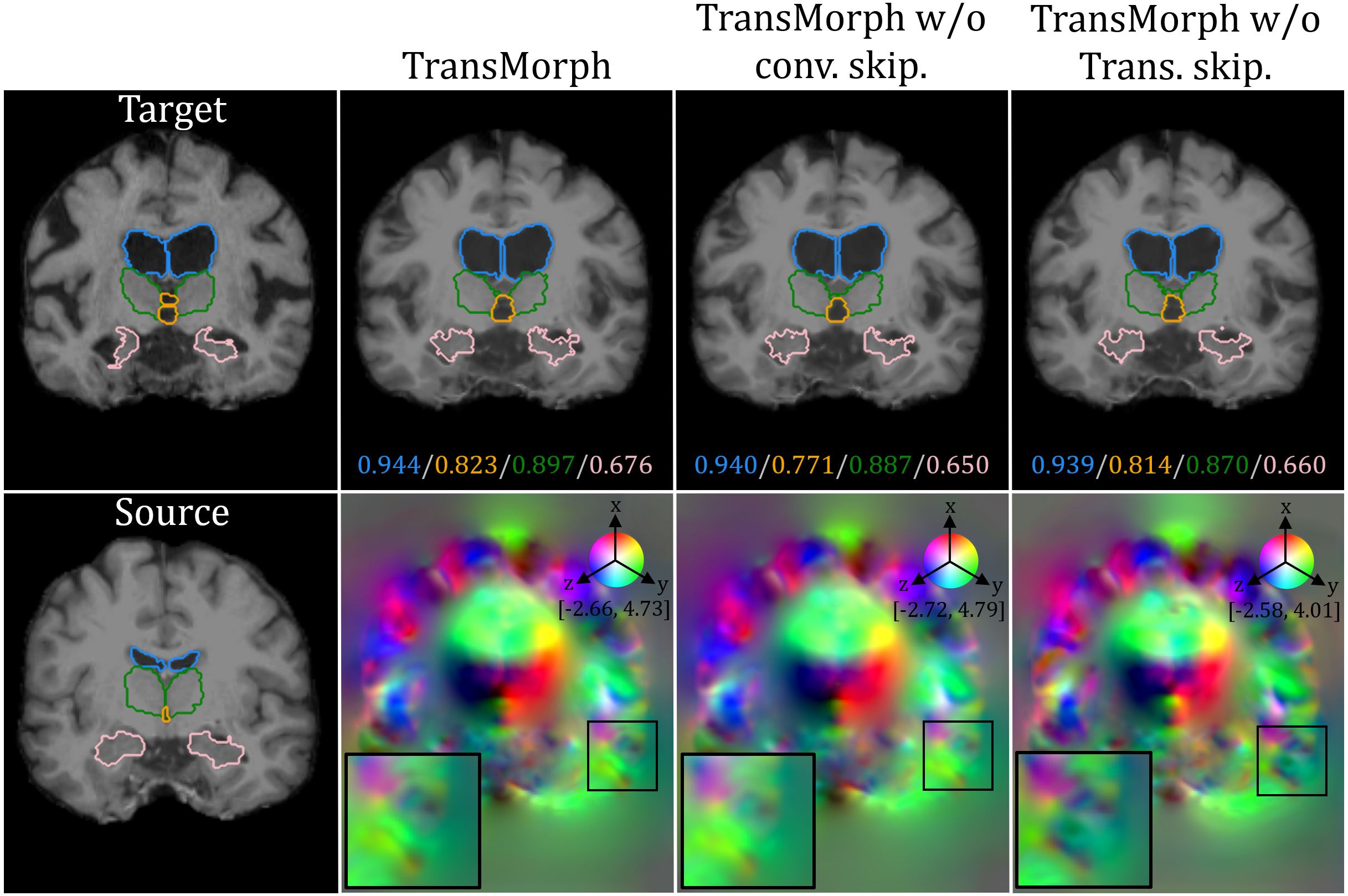 TransMorph: Transformer for unsupervised medical image registration | DeepAI