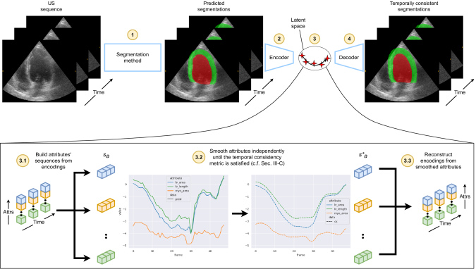 Echocardiography Segmentation with Enforced Temporal Consistency | DeepAI