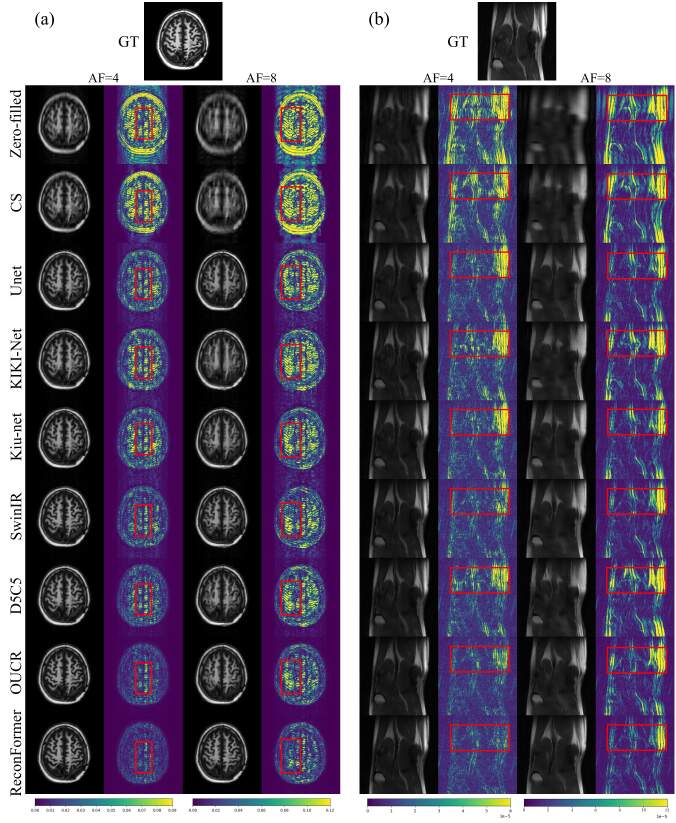 ReconFormer: Accelerated MRI Reconstruction Using Recurrent Transformer ...