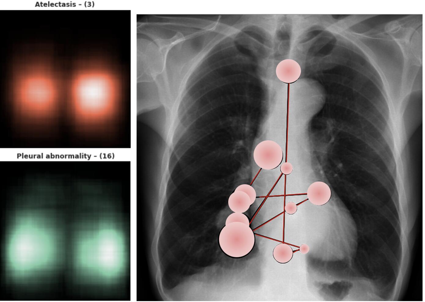 Improving X-ray Diagnostics through Eye-Tracking and XR | DeepAI