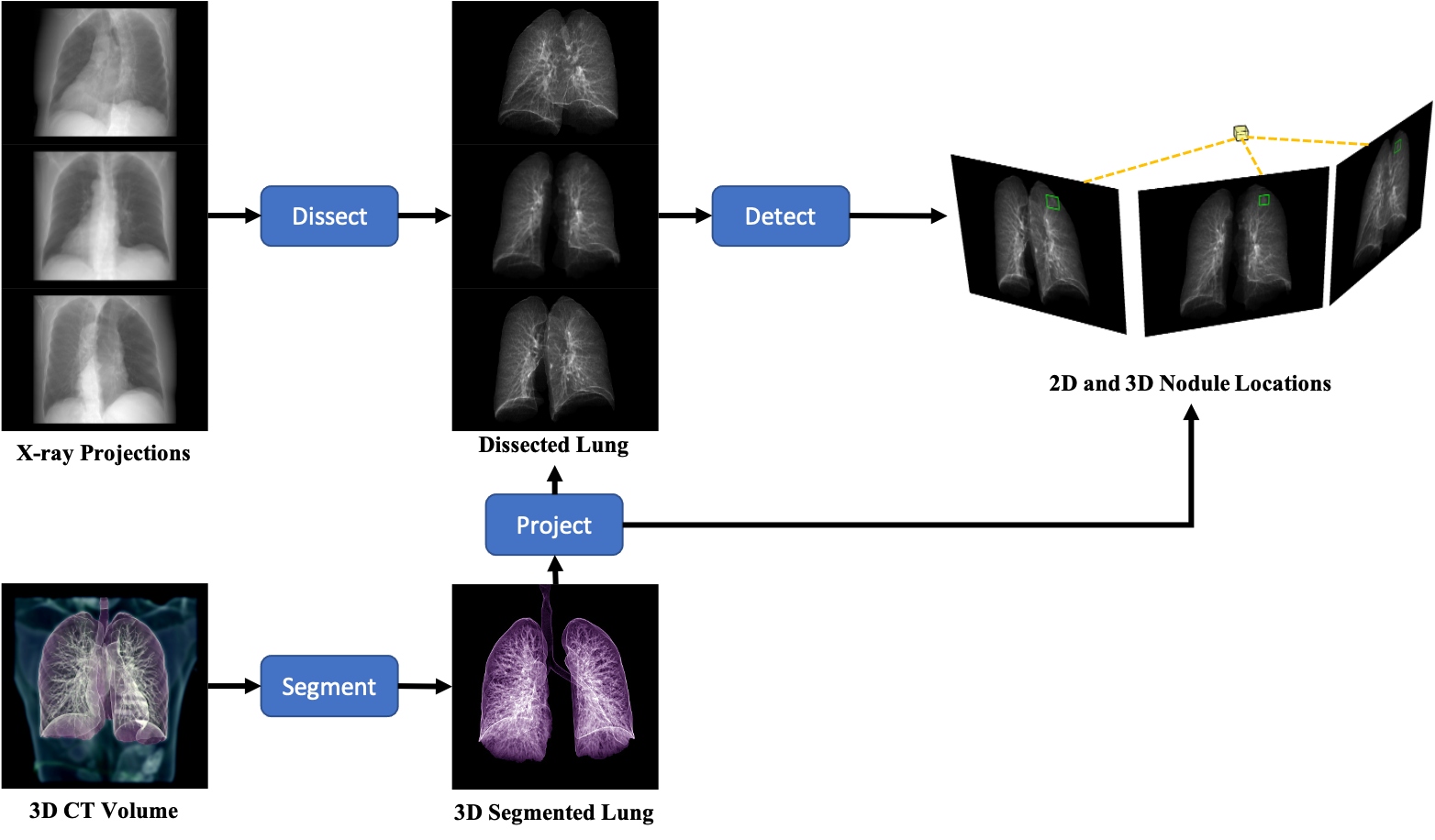 X-ray Dissectography Improves Lung Nodule Detection | DeepAI