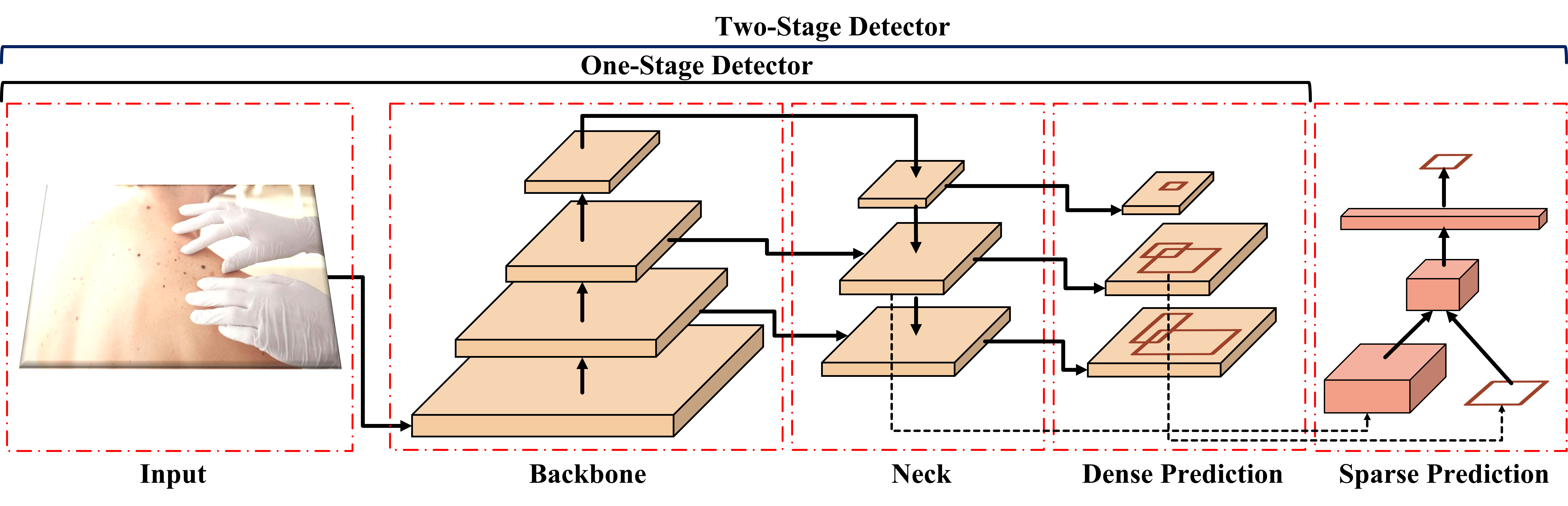 Monitoring of Pigmented Skin Lesions Using 3D Whole Body Imaging | DeepAI