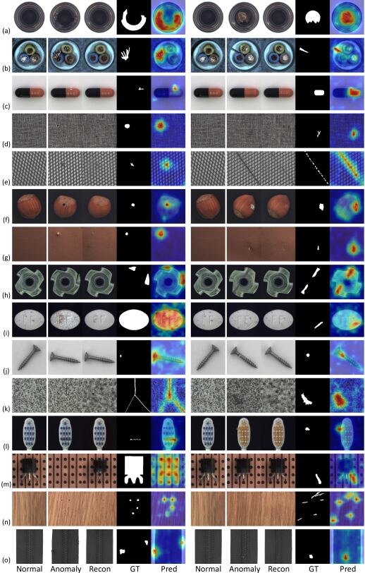 A Unified Model For Multi Class Anomaly Detection Deepai 4499