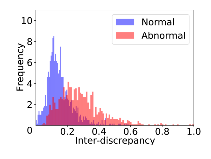 Dual-Distribution Discrepancy for Anomaly Detection in Chest X-Rays ...