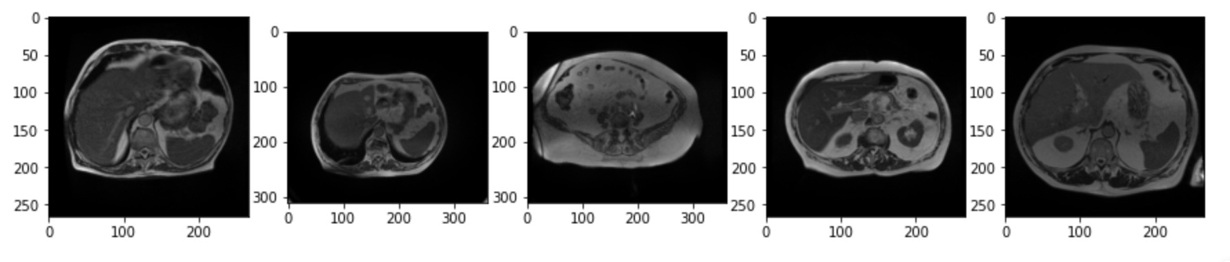 Automated GI tract segmentation using deep learning | DeepAI