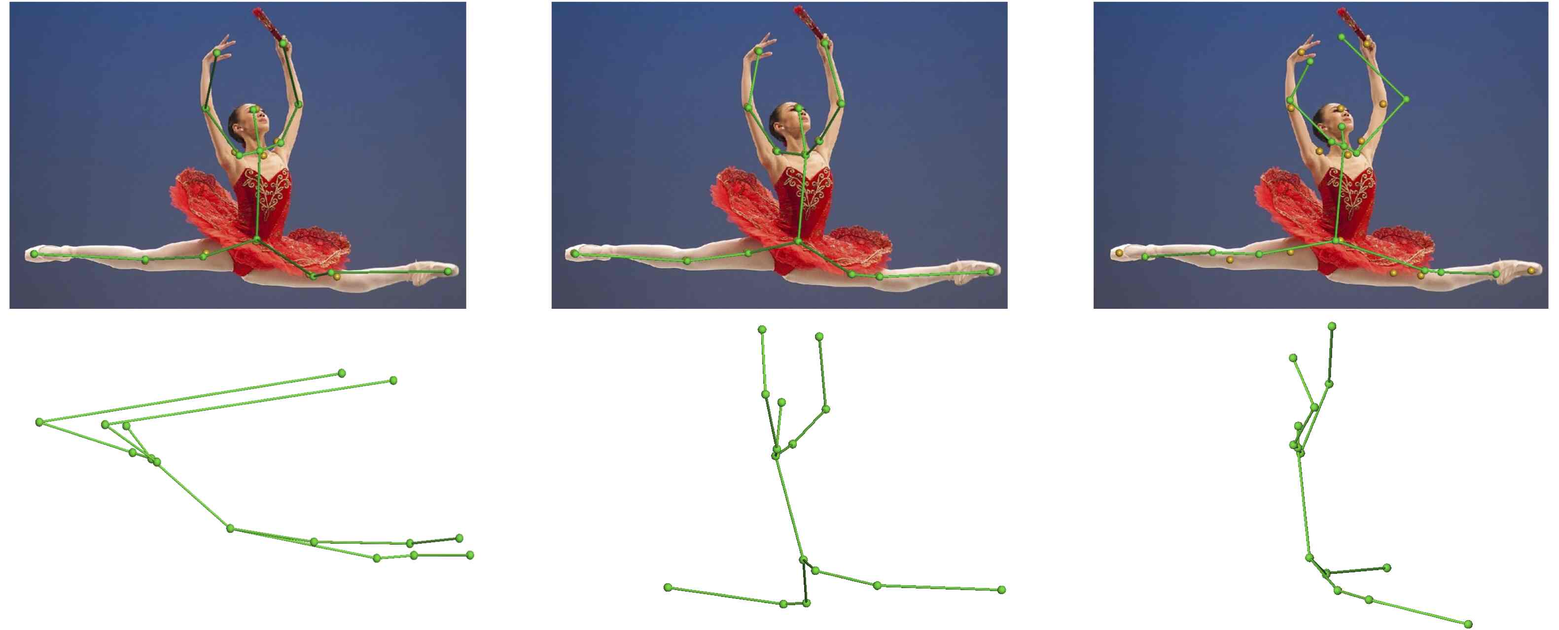 A Kendall Shape Space Approach to 3D Shape Estimation from 2D Landmarks ...