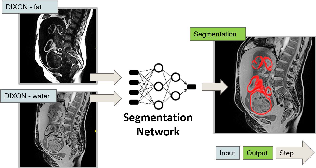 Automatic fetal fat quantification from MRI | DeepAI