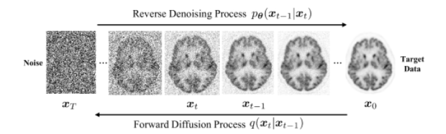 PET image denoising based on denoising diffusion probabilistic models | DeepAI