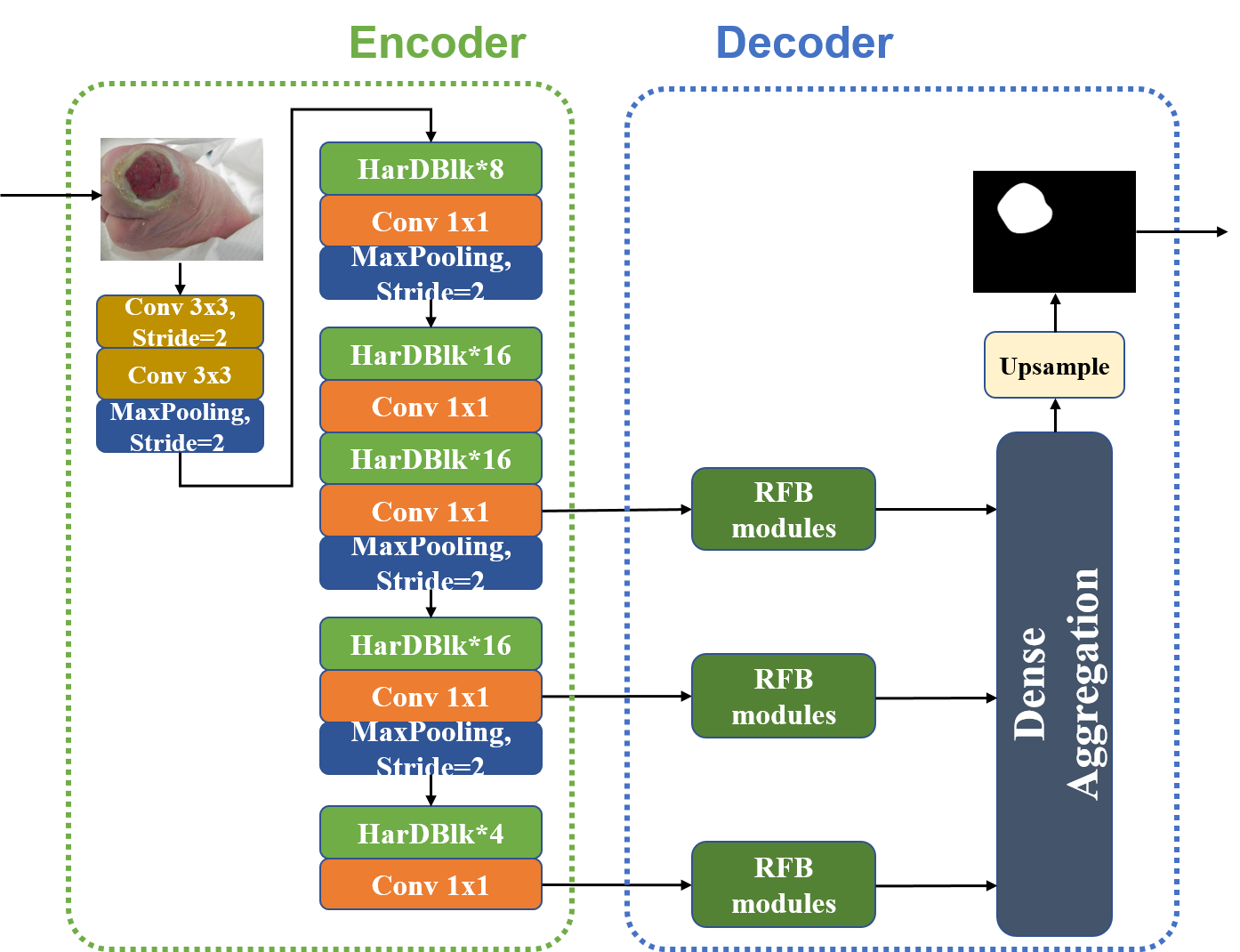 HarDNet-DFUS: An Enhanced Harmonically-Connected Network for Diabetic Foot Ulcer Image ...