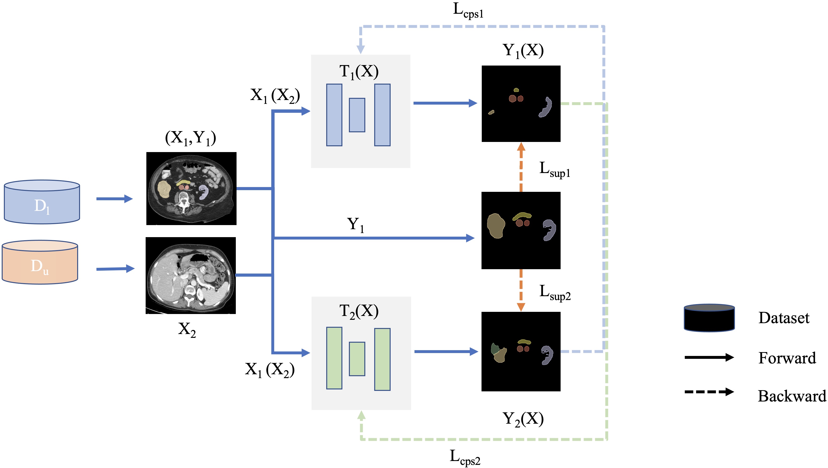 3d Cross Pseudo Supervision 3d Cps A Semi Supervised Nnu Net Architecture For Abdominal Organ 3284