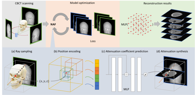 NAF: Neural Attenuation Fields for Sparse-View CBCT Reconstruction | DeepAI