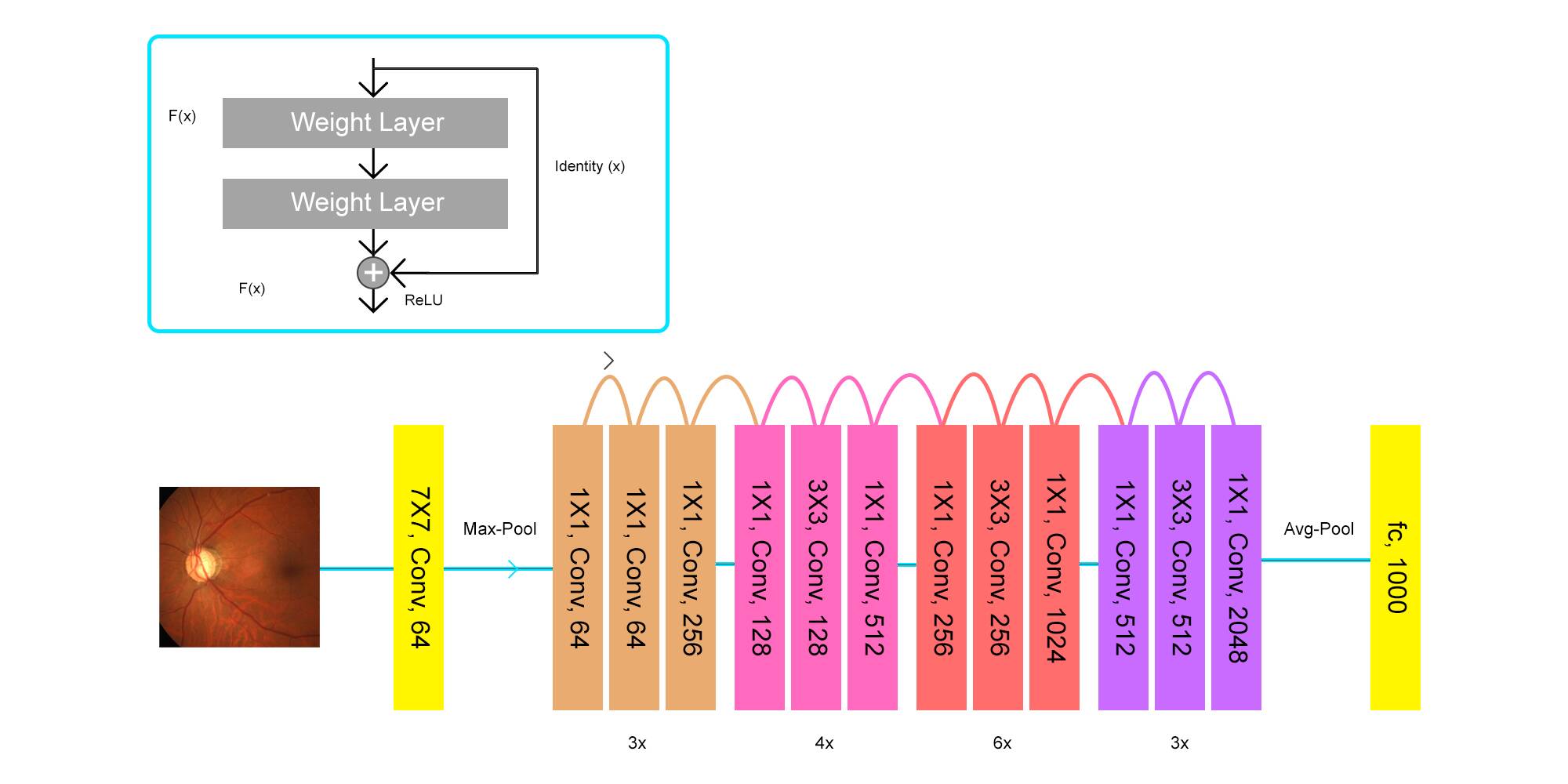 Explainable AI based Glaucoma Detection using Transfer Learning and LIME | DeepAI