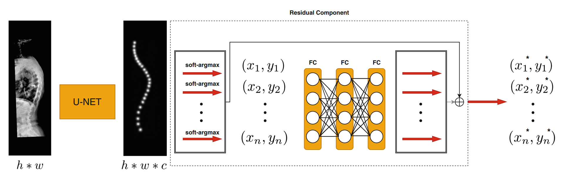 Scoliosis Detection using Deep Neural Network | DeepAI