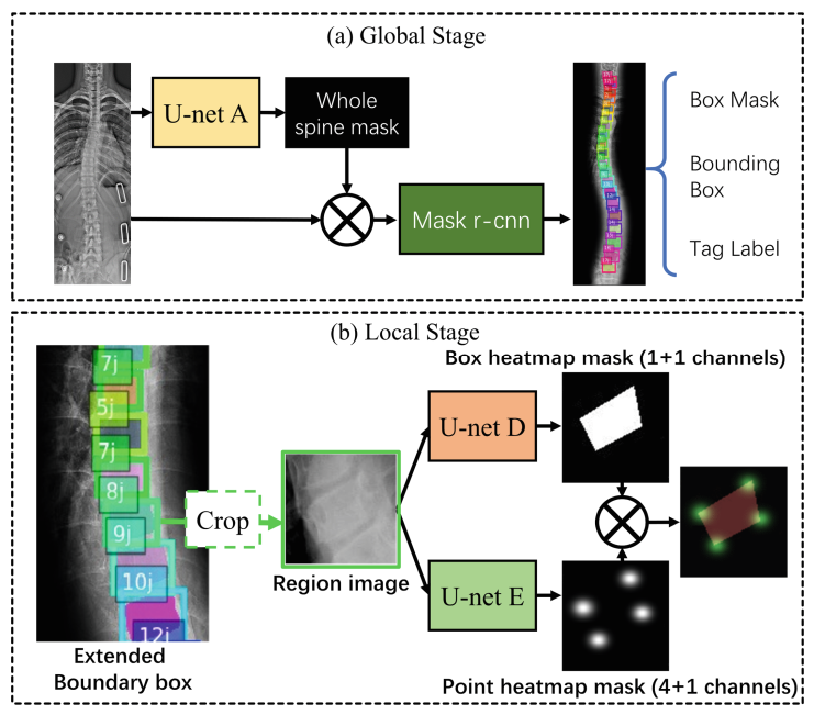 Scoliosis Detection using Deep Neural Network | DeepAI