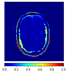 DC-cycleGAN: Bidirectional CT-to-MR Synthesis from Unpaired Data | DeepAI