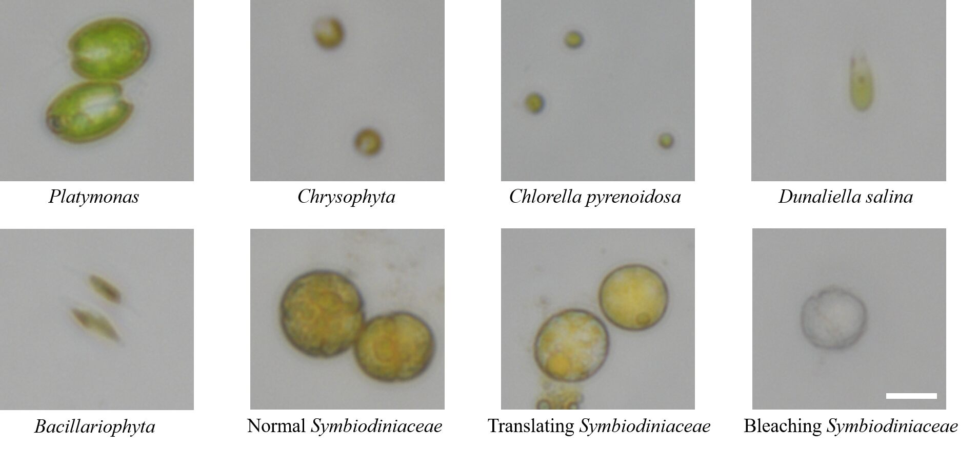 Marine Microalgae Detection In Microscopy Images A New Dataset Deepai