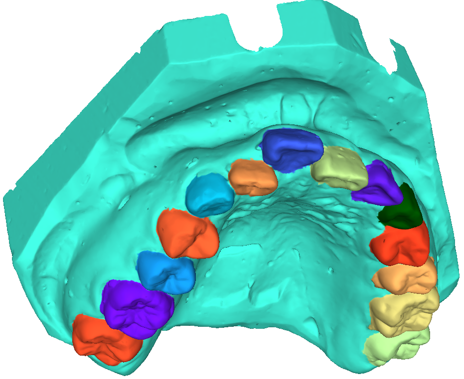 An Implicit Parametric Morphable Dental Model | DeepAI