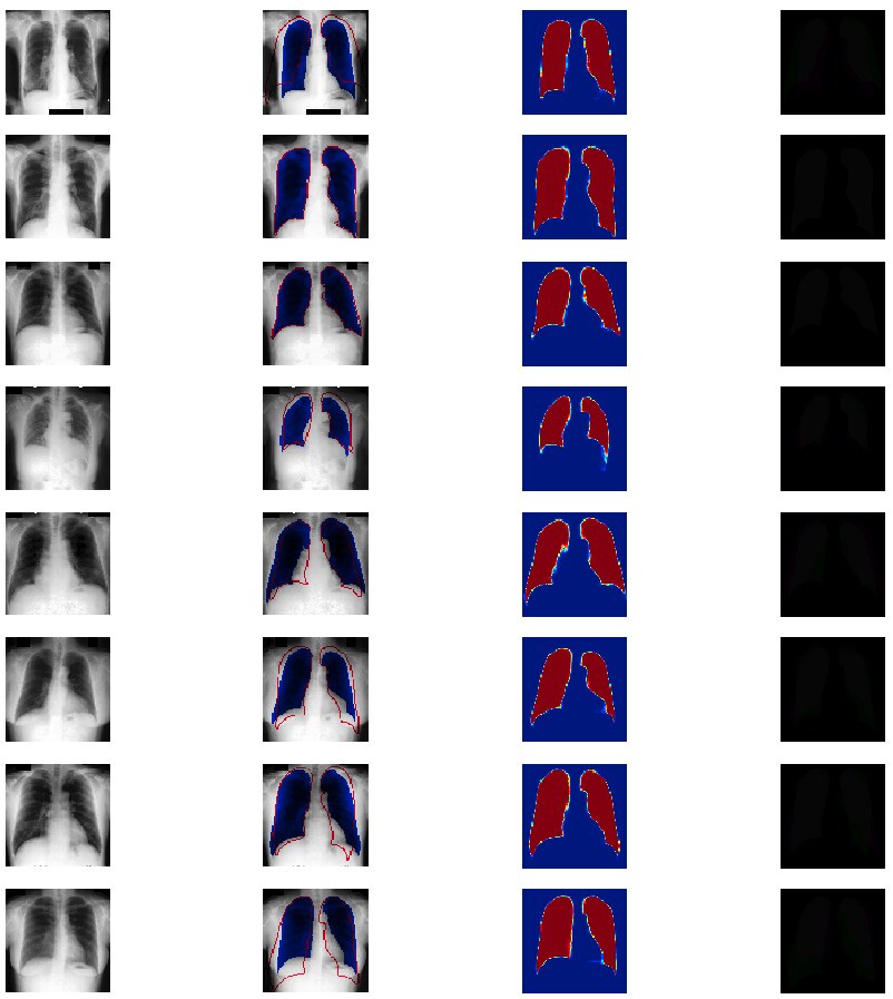 UNet Based Pipeline for Lung Segmentation from Chest X-Ray Images | DeepAI
