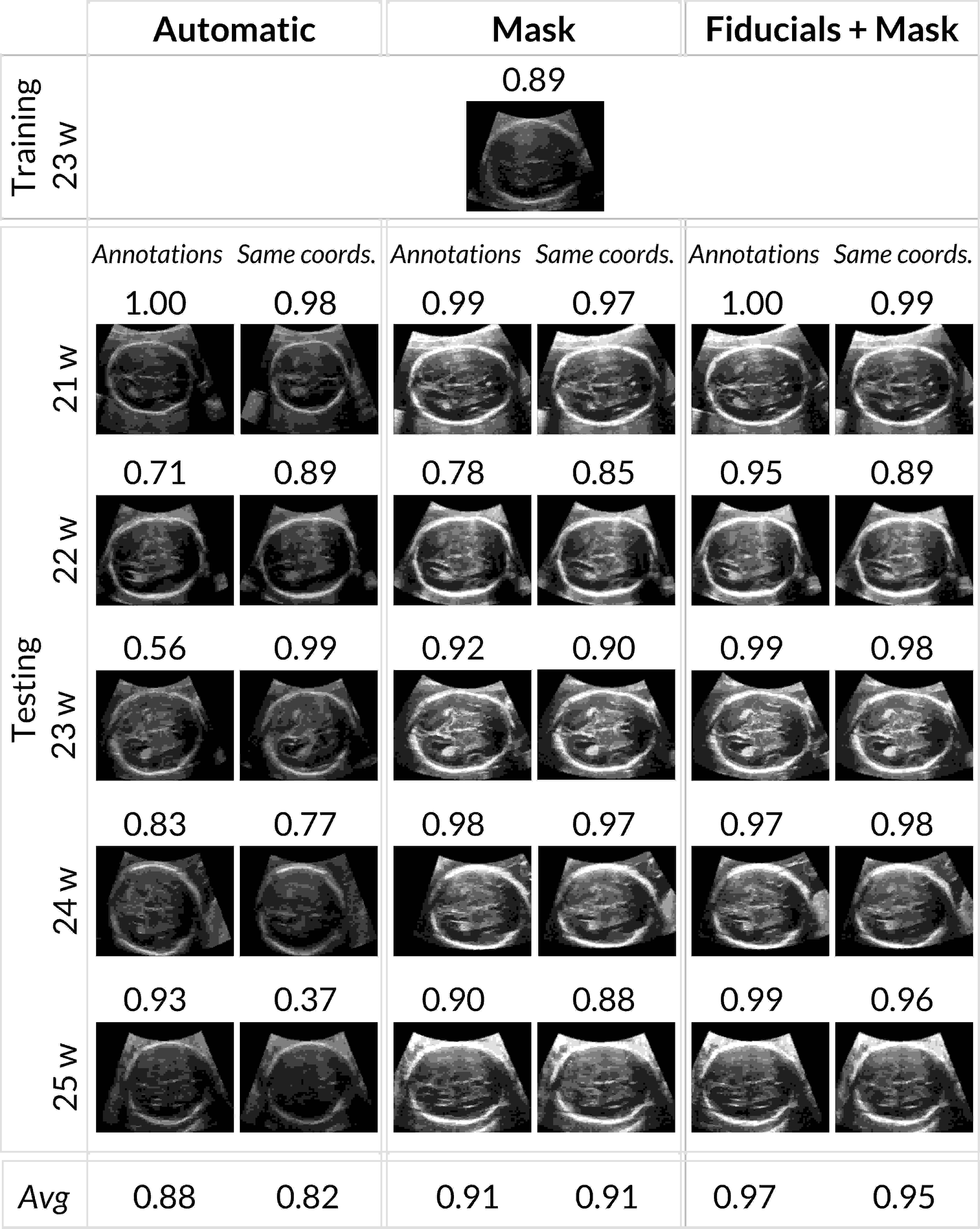 Learning ultrasound plane pose regression: assessing generalized pose ...