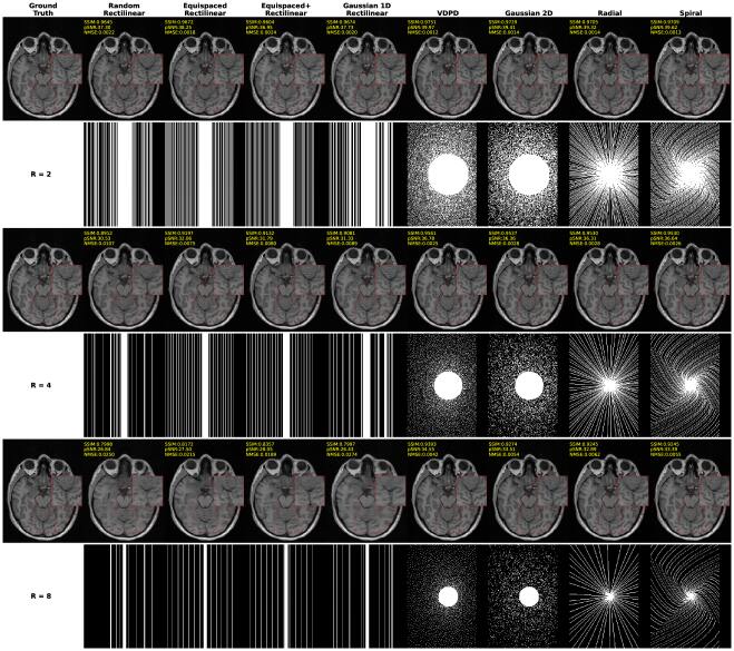 On Retrospective k-space Subsampling schemes For Deep MRI ...