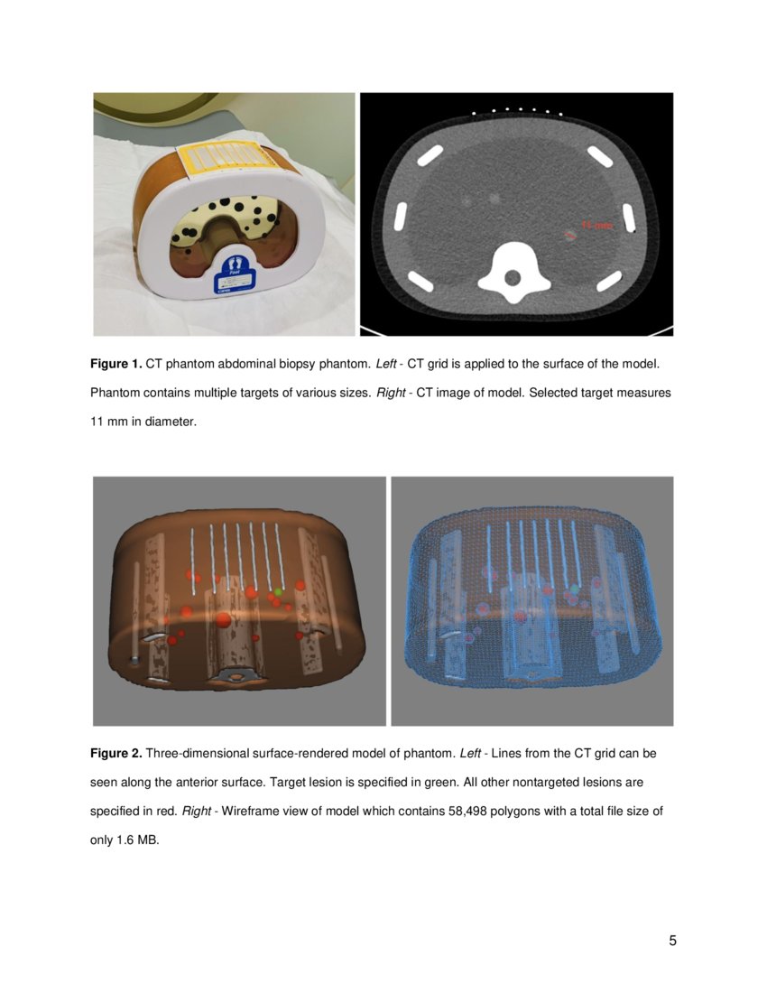 3D Augmented Reality-Assisted CT-Guided Interventions: System Design ...