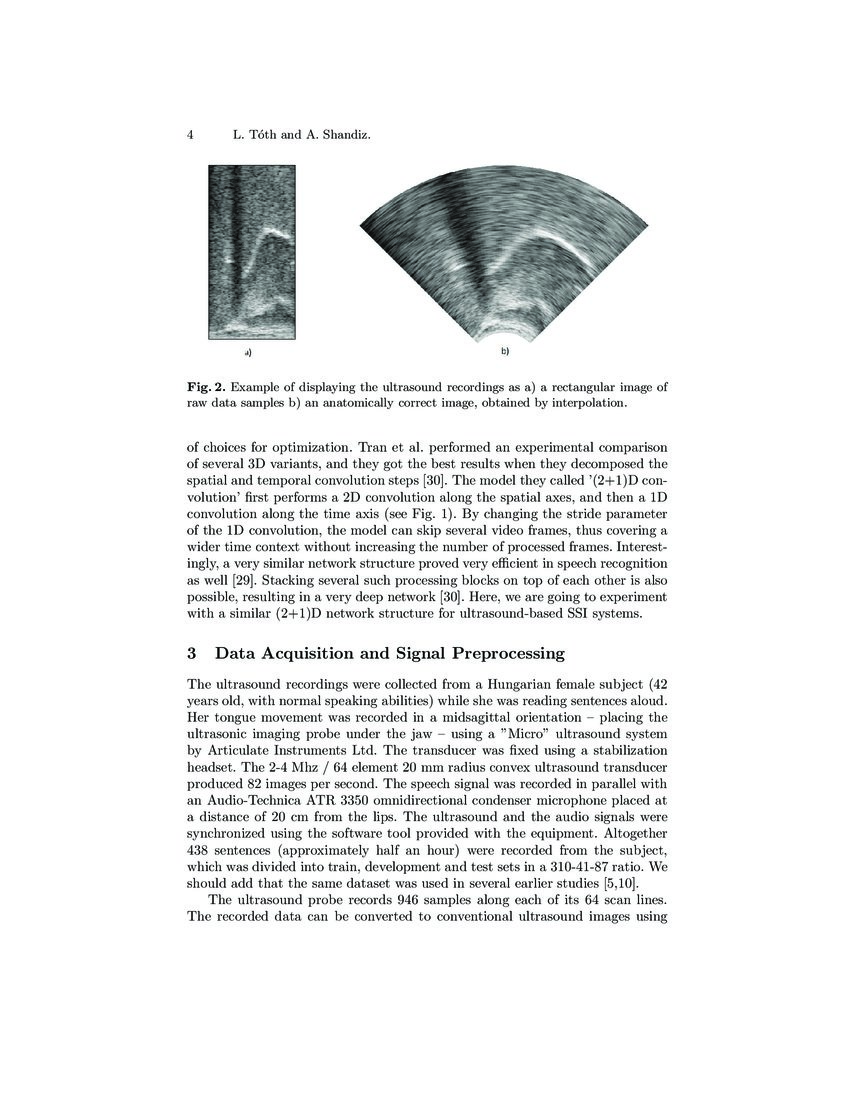3D Convolutional Neural Networks for Ultrasound-Based Silent Speech Interfaces | DeepAI