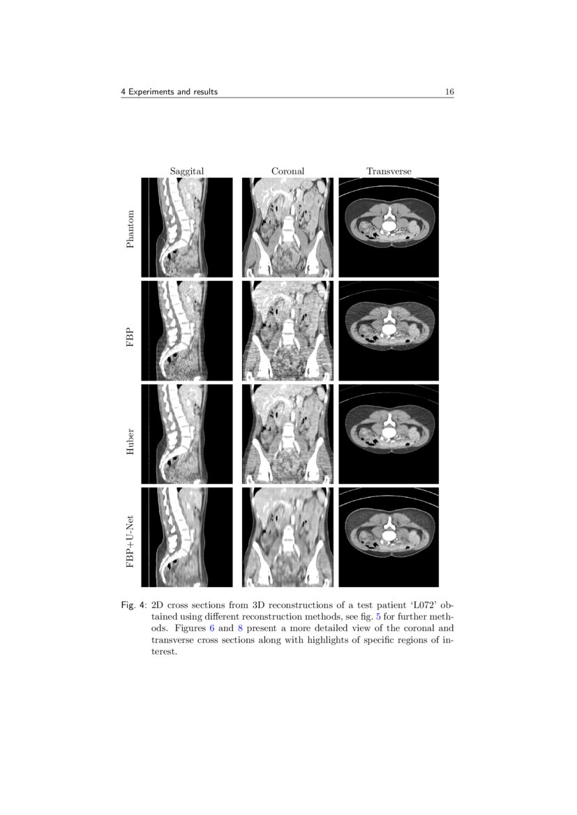 3D helical CT reconstruction with memory efficient invertible Learned ...