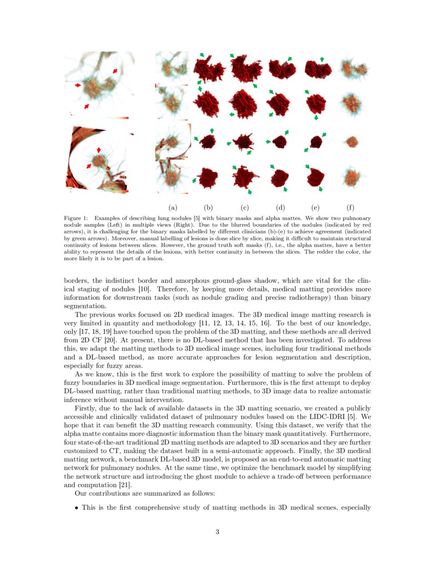 3D Matting: A Benchmark Study on Soft Segmentation Method for Pulmonary Nodules Applied in ...