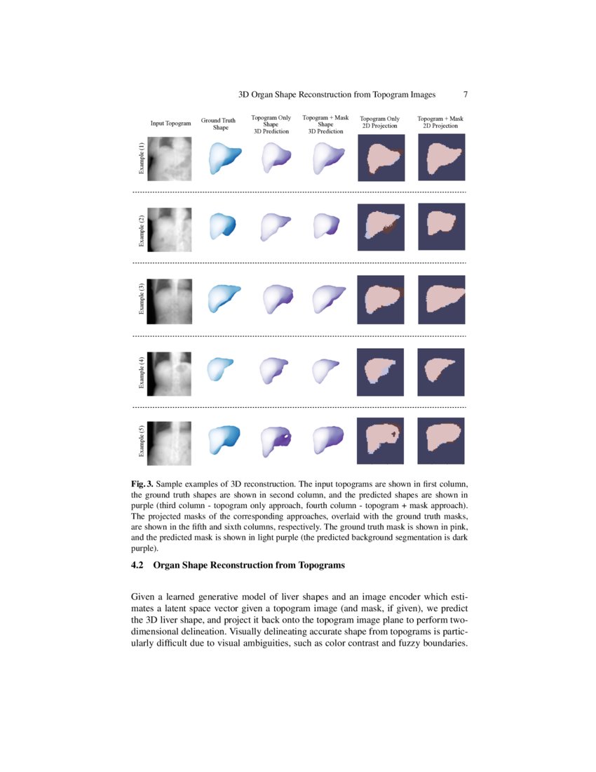 3D Organ Shape Reconstruction from Topogram Images | DeepAI
