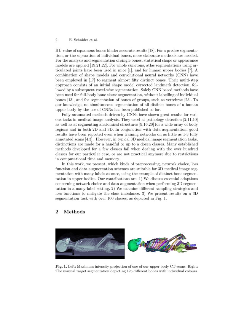 3d Segmentation Networks For Excessive Numbers Of Classes Distinct Bone Segmentation In Upper