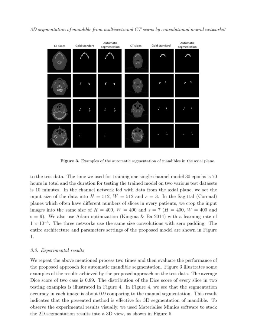 3D segmentation of mandible from multisectional CT scans by convolutional neural networks | DeepAI