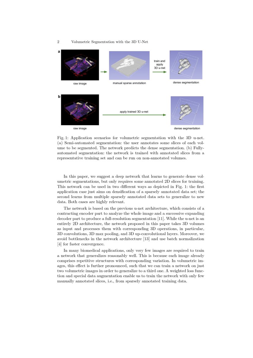 3D U-Net: Learning Dense Volumetric Segmentation from Sparse Annotation | DeepAI