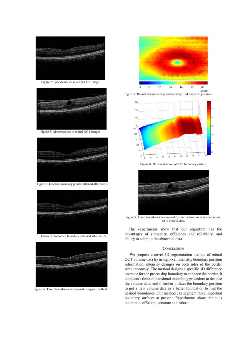 A 3D Segmentation Method for Retinal Optical Coherence Tomography Volume Data | DeepAI