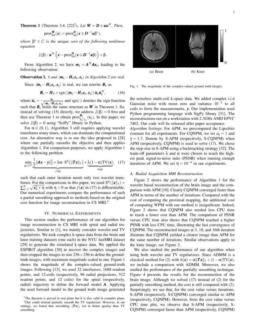 A Complex Quasi Newton Proximal Method For Image Reconstruction In Compressed Sensing Mri Deepai