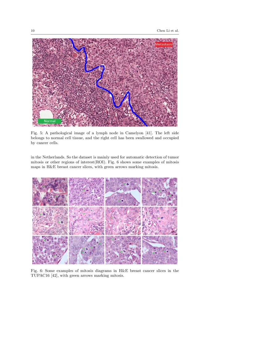 A Comprehensive Review Of Computer Aided Whole Slide Image Analysis