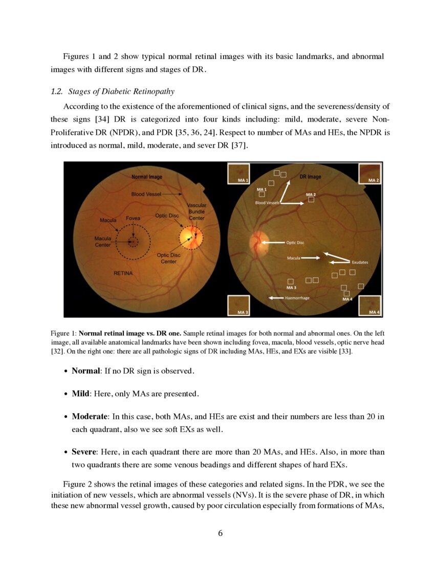 A comprehensive survey on computer-aided diagnostic systems in diabetic ...