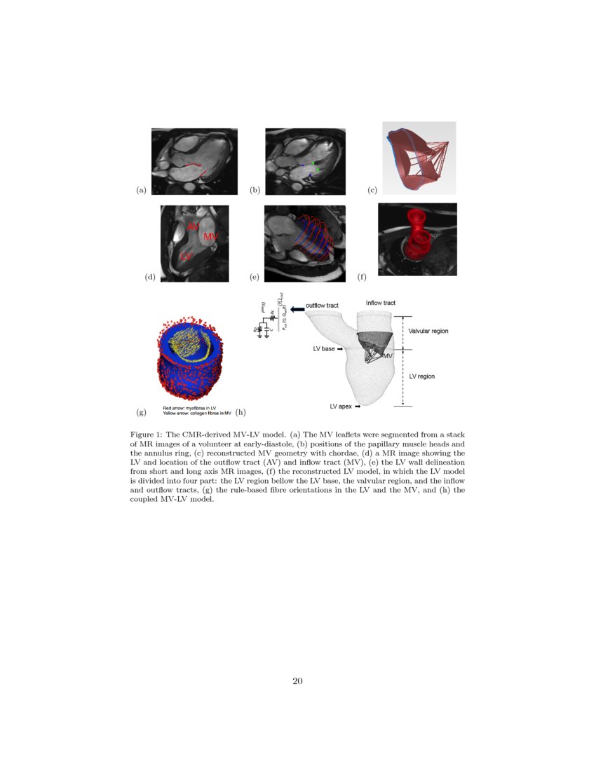 A Coupled Mitral Valve Left Ventricle Model With Fluid Structure Interaction Deepai