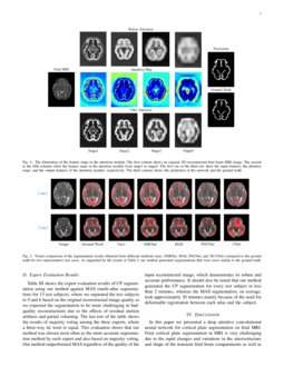 A Deep Attentive Convolutional Neural Network for Automatic Cortical Plate Segmentation in Fetal ...