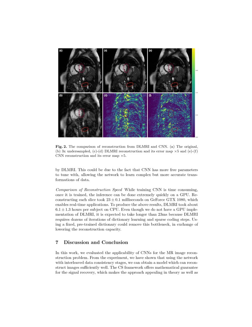 A Deep Cascade of Convolutional Neural Networks for MR Image ...