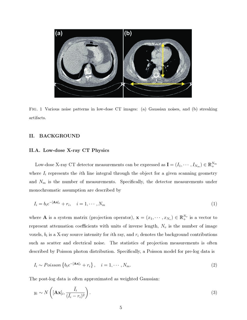 A Deep Convolutional Neural Network Using Directional Wavelets For Low Dose X Ray Ct
