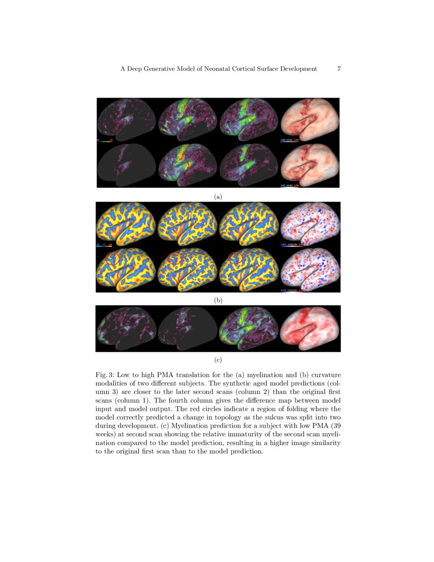 A Deep Generative Model of Neonatal Cortical Surface Development | DeepAI