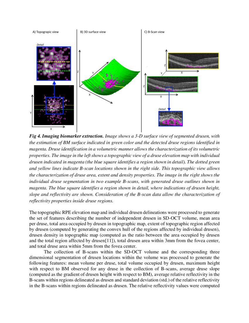 A Deep Learning Approach For Prognosis Of Age Related Macular Degeneration Disease Using Sd Oct