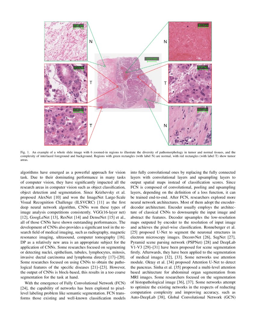 A Deep Learning Based Multiscale Approach To Segment Cancer Area In
