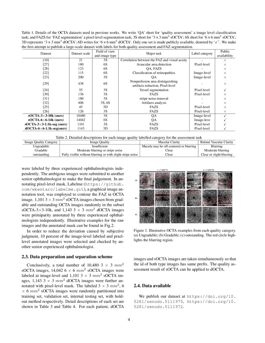 A Deep Learning Based Quality Assessment And Segmentation System With A Large Scale Benchmark